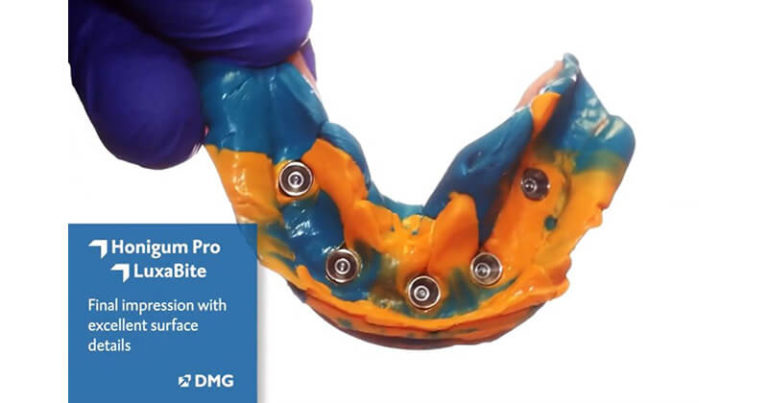 bite registration Archives - DMG America